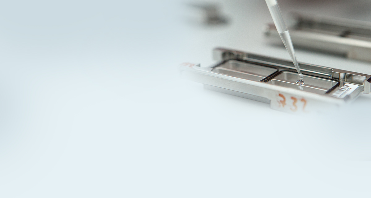 Array-CGH | Genetics